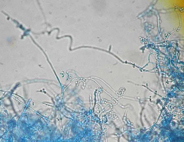 ATLAS MICOLOGIA: TRICHOPHYTON INTERDIGITALE