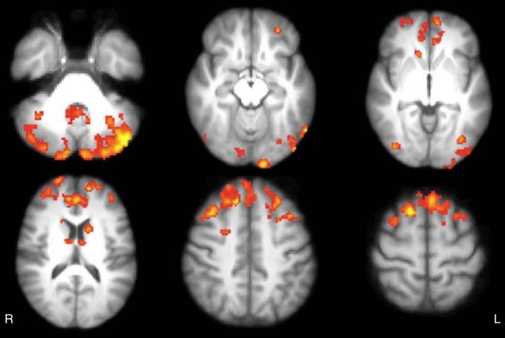 Dr Fotis Liarokapis Video Games Improve Brain Connections In Multiple dr-fotis-liarokapis-video-games-improve-brain-connections-in-multiple