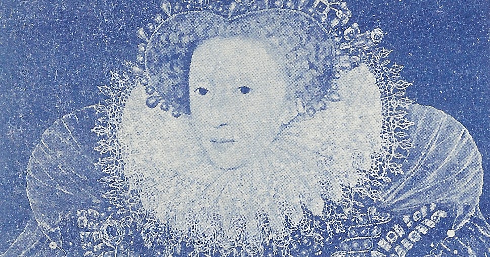 Looking Back on Dentistry: DENTAL PROBLEMS OF FAMOUS HISTORICAL ...