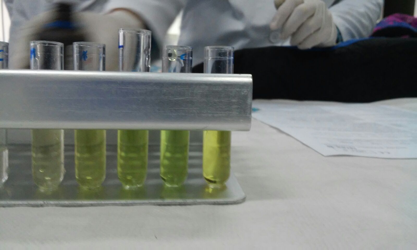 Prácticas Bioquímica: Determinación de urea