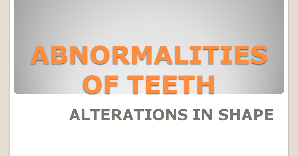 Dental Notes: Abnormalities of Teeth (Alterations in Shape) NOTES