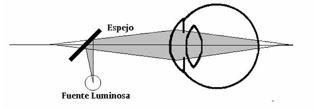 Retinoscopía