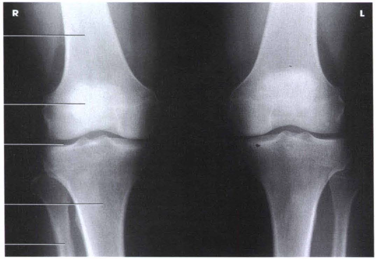 teknik radiografi: 2017