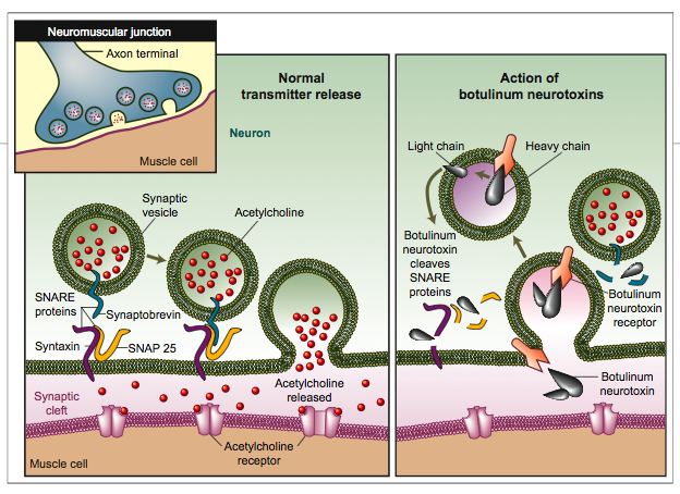 Microbiologia de los alimentos: Intoxicación Clostridium botulinum ...