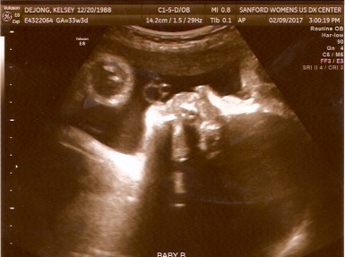 Twins- Third Trimester #2. ~ A Day with the De Jongs