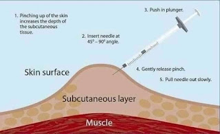 How to Inject Insulin