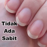 Tahukah Kamu Sabit di Kuku Menunjukkan Kesehatanmu! | zeropromosi | souvenir barang promosi ...