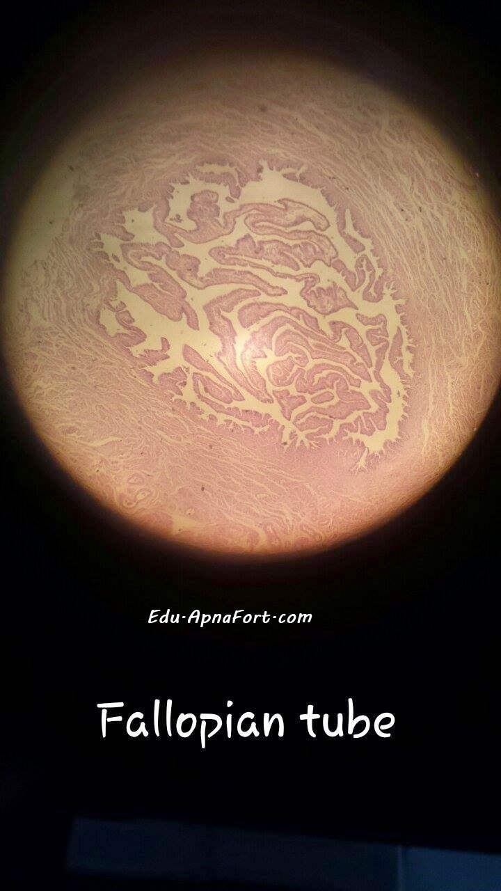 Educational Blog : Fallopian Tubes slides