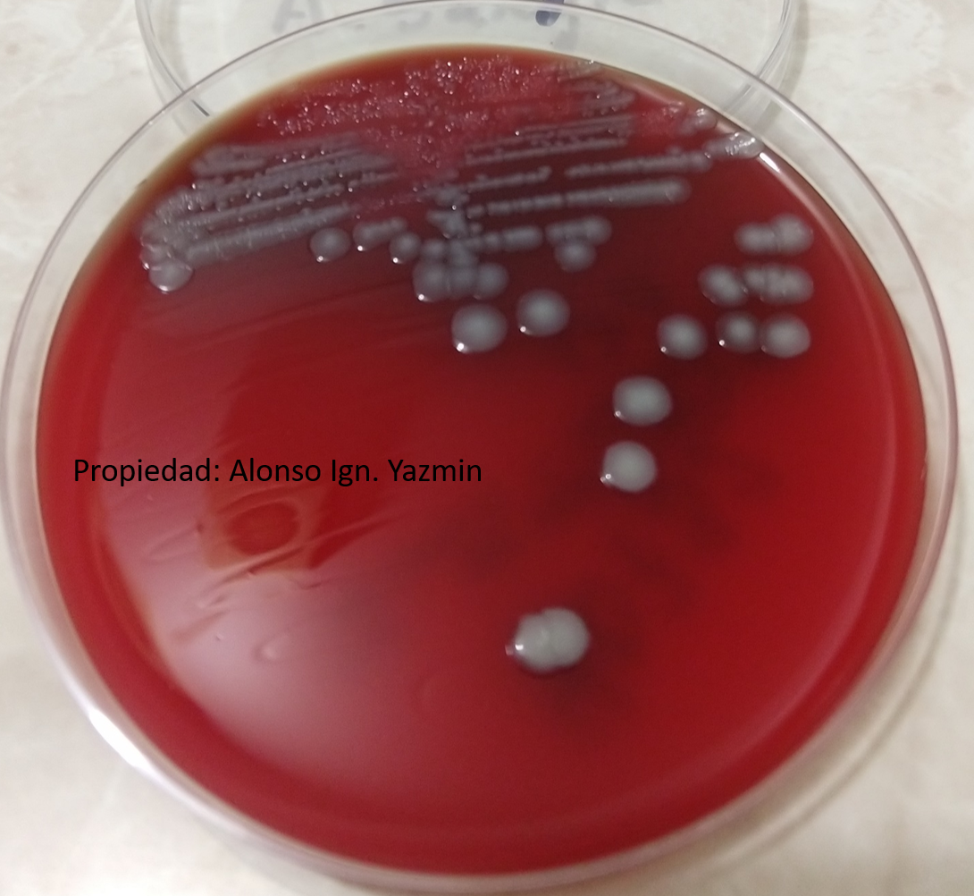 Bioquímica Diagnóstica BQD-YAI: Escherichia coli