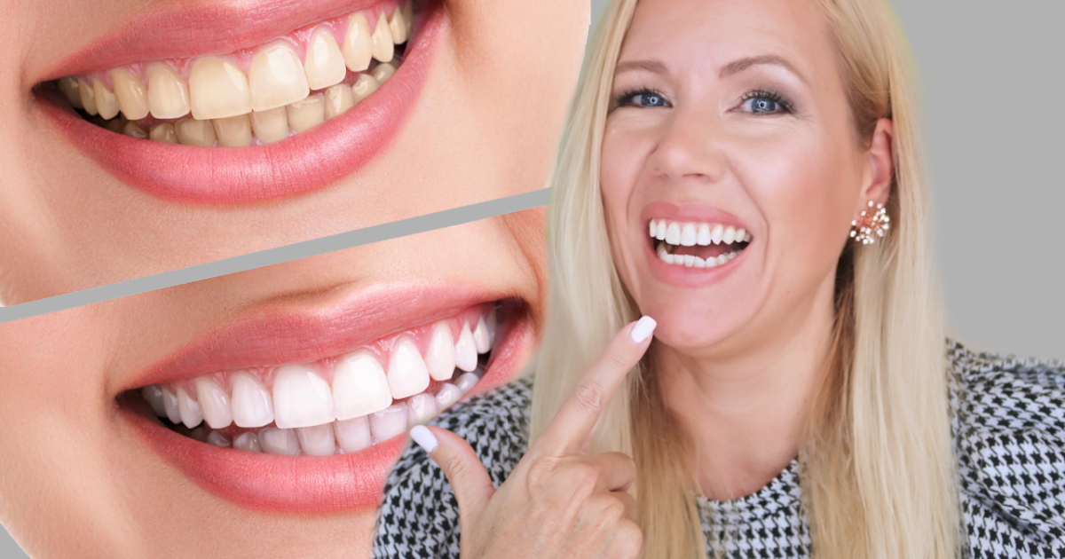 How to professionally clean your teeth like a dental hygienist!