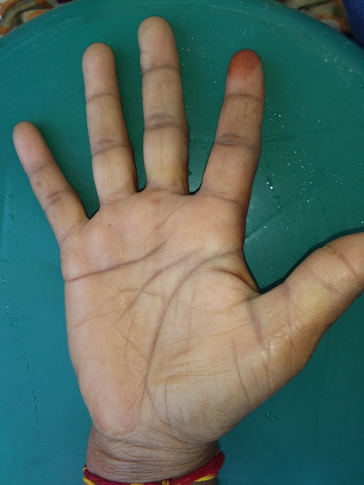 Head Line Starts Late From Underneath Middle Finger & Index Finger ...