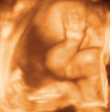 Our Nine Month Project: 3D Ultrasound @ 26 weeks