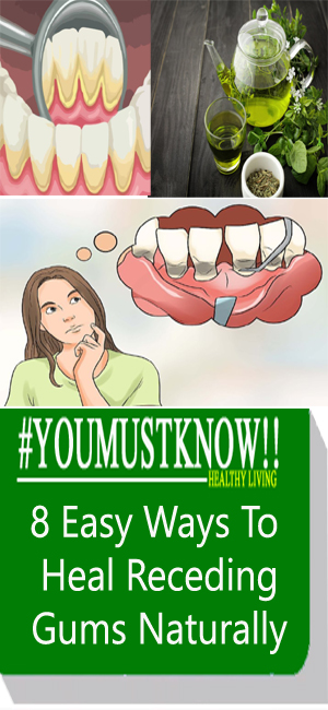 8 Easy Ways To Heal Receding Gums Naturally Nutrition Health