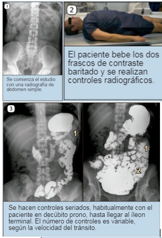PROTOCOLO DE ESTUDIOS ESPECIALES: TRÁNSITO INTESTINAL