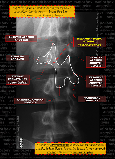 Radiology Archives: Short Lecture n.1 - Scotty Dog Sign