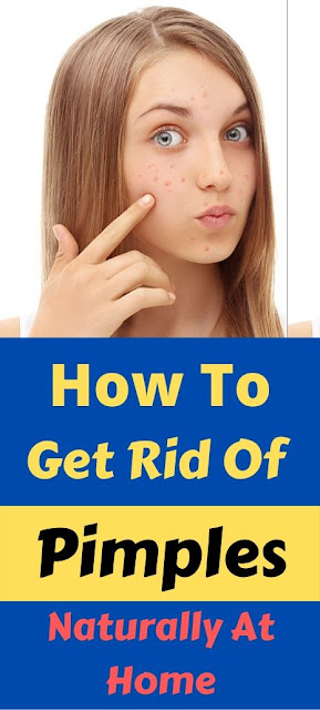 How To Get Rid Of Pimples Naturally Overnight Fast ~ SKINCARE