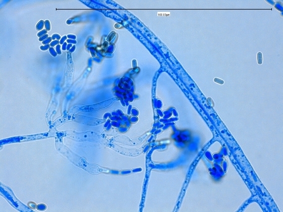 Fun With Microbiology (What's Buggin' You?): Arthrographis species