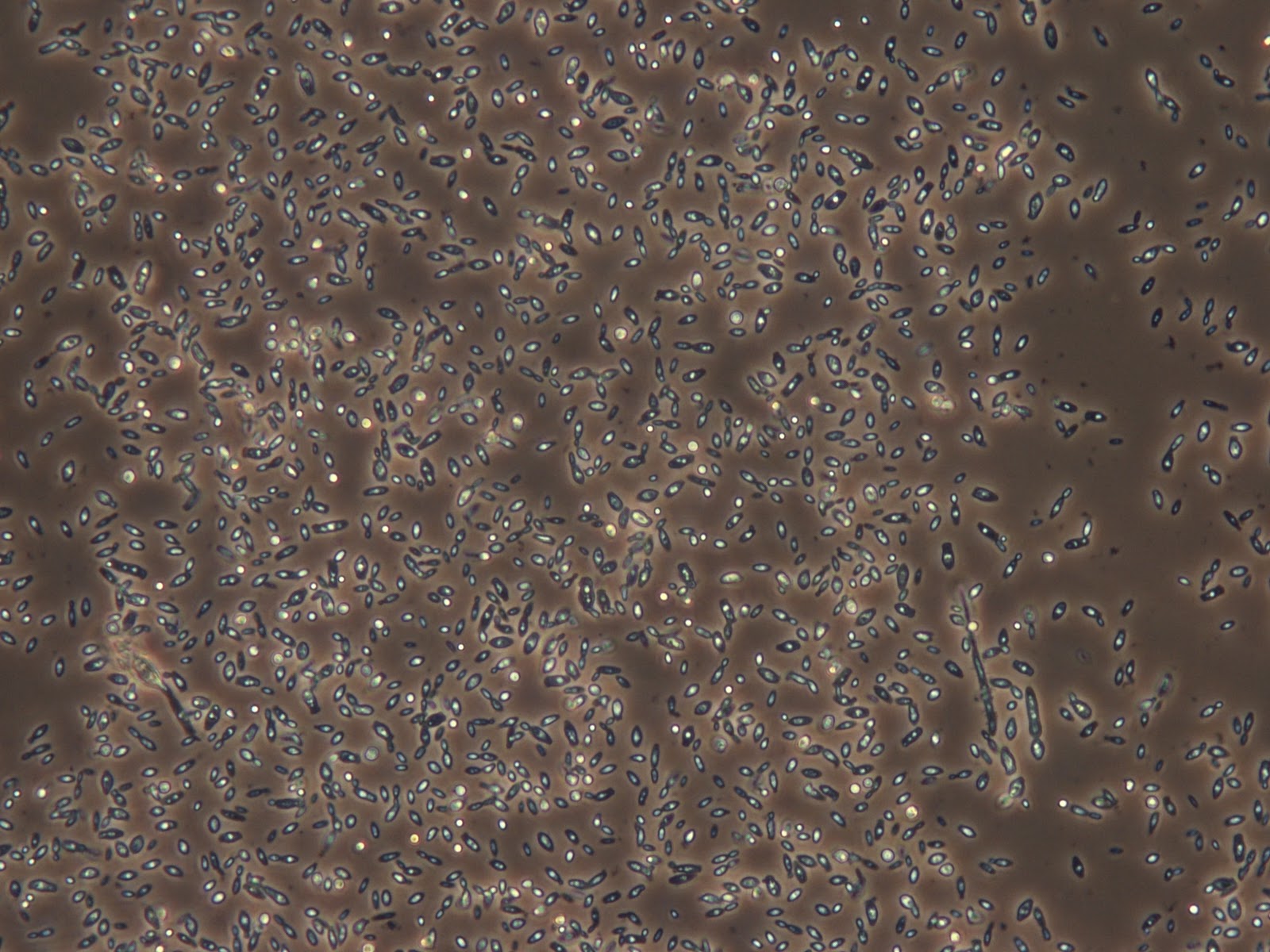 Ed's Beer Site: The Brewing Science of Brettanomyces