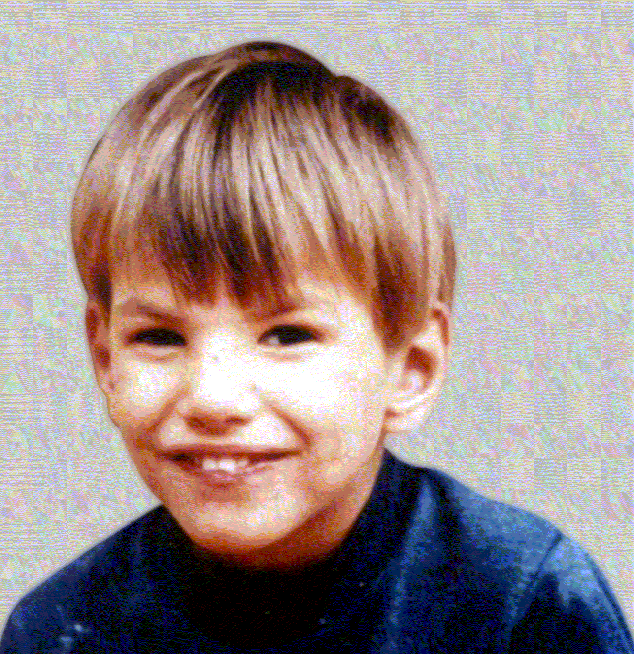 Malformaciones Genéticas Desconocidas: Síndrome de cri du chat