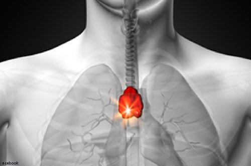 Casos de Salud: ¿Qué es el Timo?