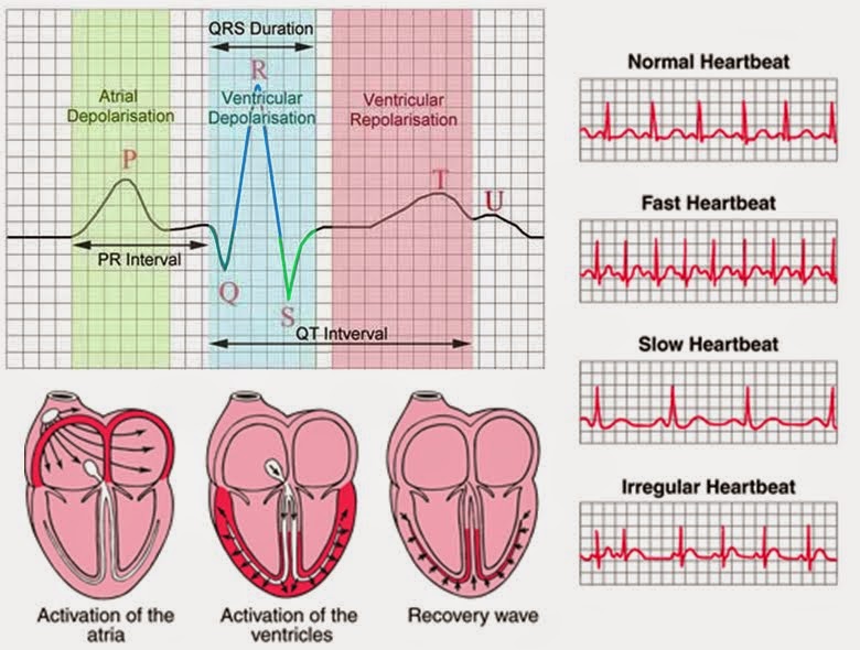 Wellness Lab Health Info: Electrocardiogram (ECG)