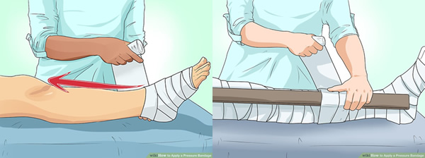 REM: Snake Bite / Envenomation - IVLine