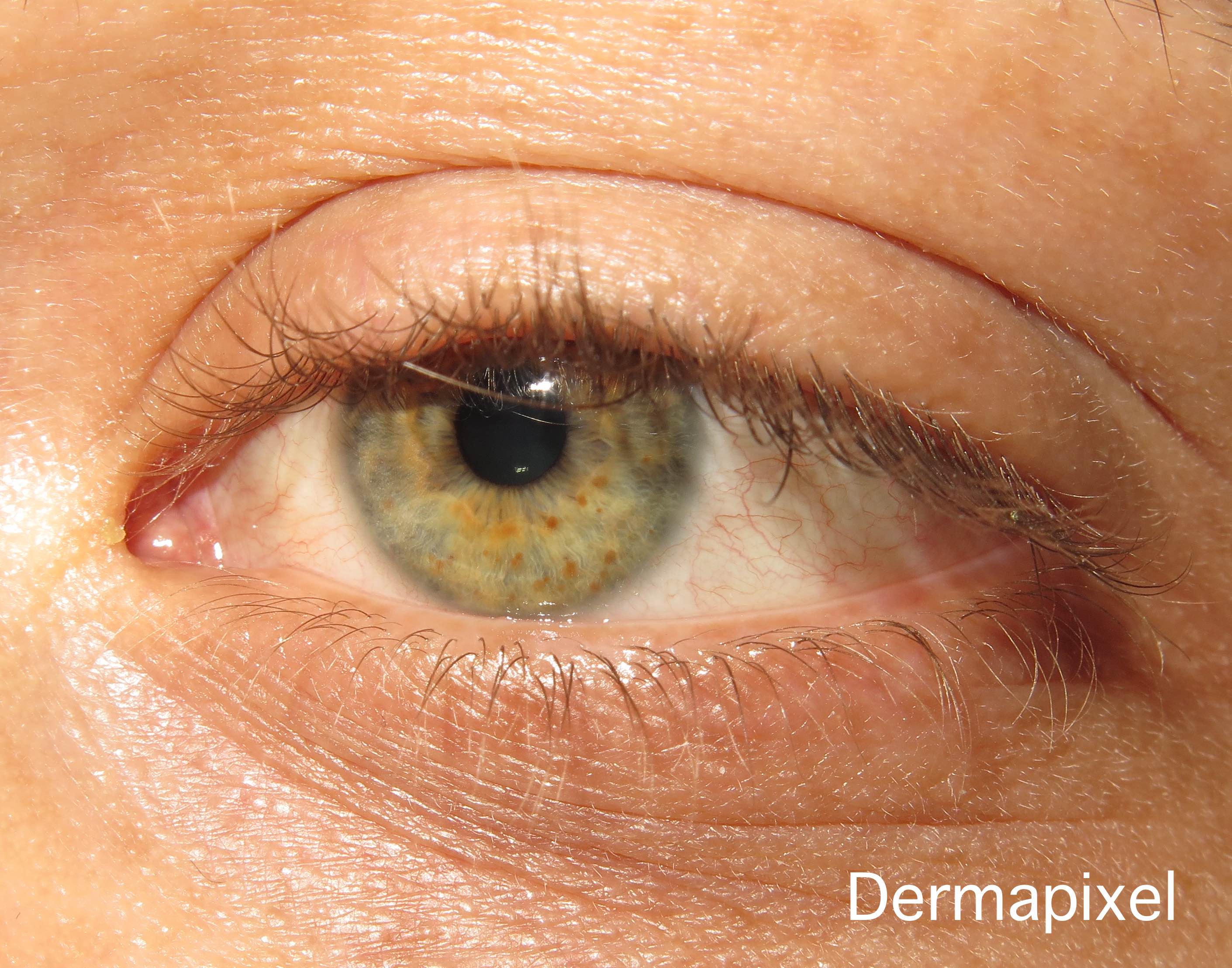 Dermapixel: julio 2021