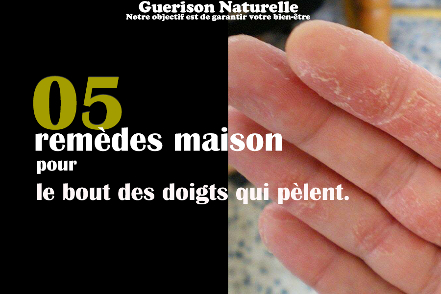 Emillyapos: Les 5 meilleurs remèdes maison pour le bout des doigts qui ...