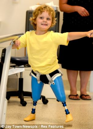 Welcome to Yugotee's blog! Be Inspired!: The boy born with no ankles or ...