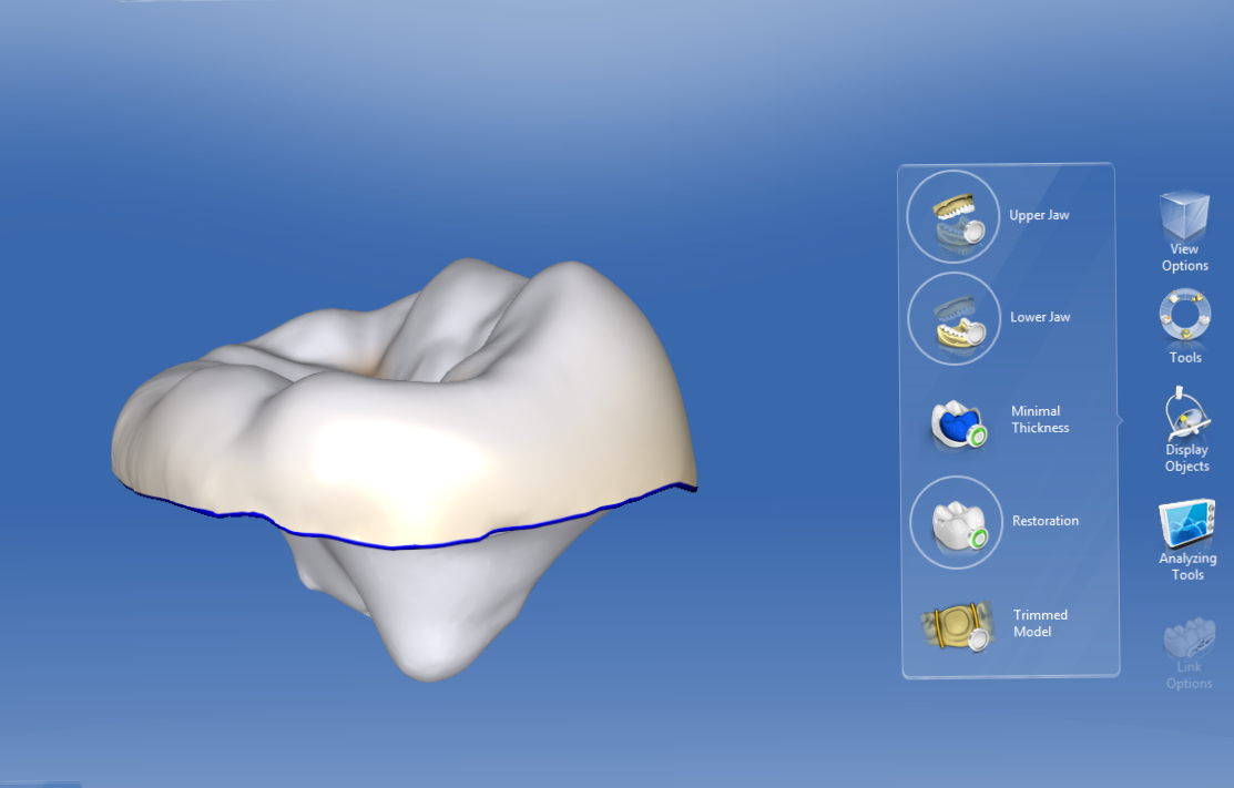 Endocrown .. Full documentation of a clinical case | Dental Esthetics