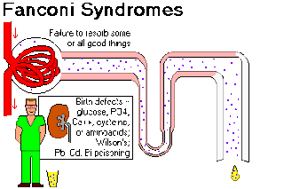 Renal-disease: What is Fanconi syndrome(Fanconi's syndrome)