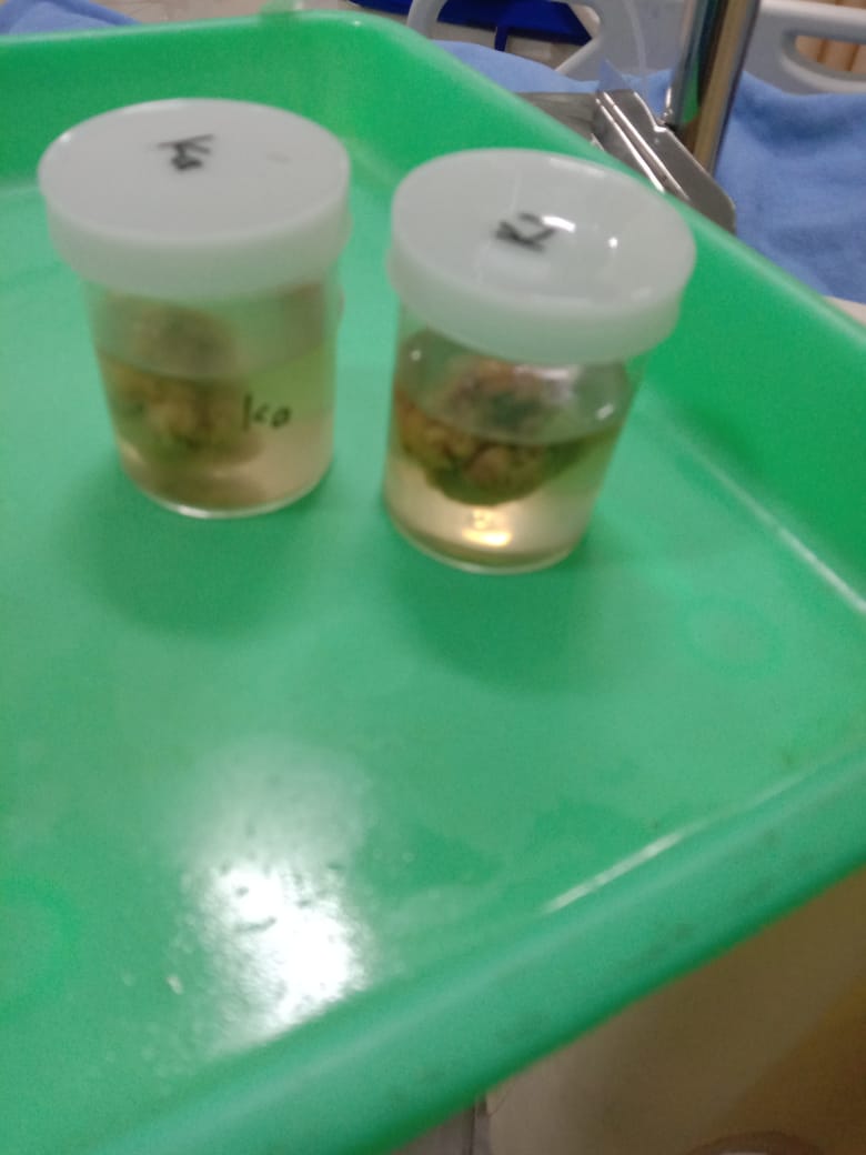 Pengalaman "Seru" Operasi Tumor Payudara di Usia 22 Tahun