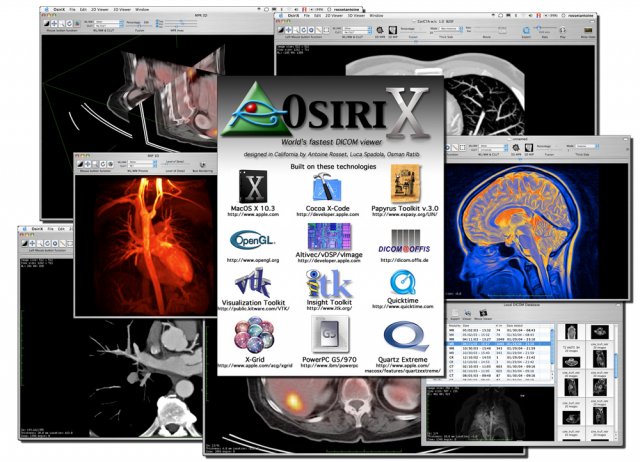 Enfoque Radiologico: Acerca de OsiriX (Estacion de trabajo PACS DICOM)...