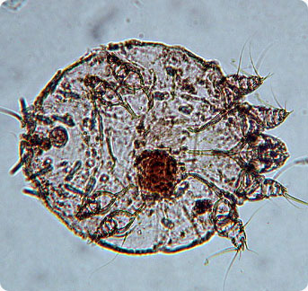 Bichos & Caprichos: Sarna sarcóptica