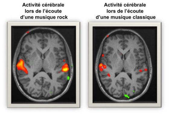 Musique et cerveau ~ Apposcience