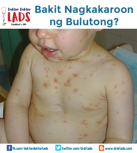 butlig butlig sa balat - DrBeckmann