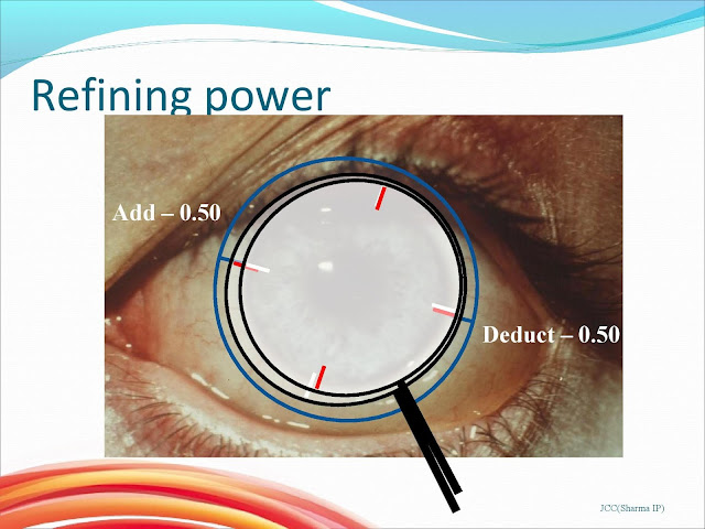 Jackson cross-cylinder - Eye Health Nepal