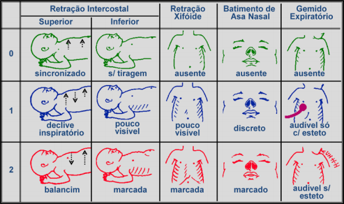 Felipe Senger: Tabela de Silverman - Andersen