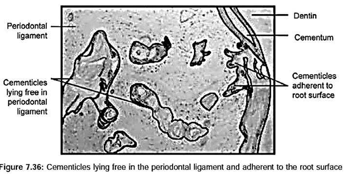 cementum structure (2) l Oral histology & biology MCQs for dental ...