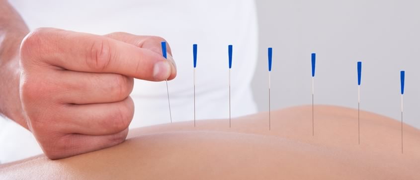 Bagaimana Proses Kerja Akupunktur Untuk Kesehatan ? - Terapi Jarum