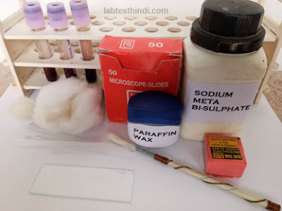 Sickle Cell क्या है | Sickling Test कैसे करते है – ( Slide Method ...