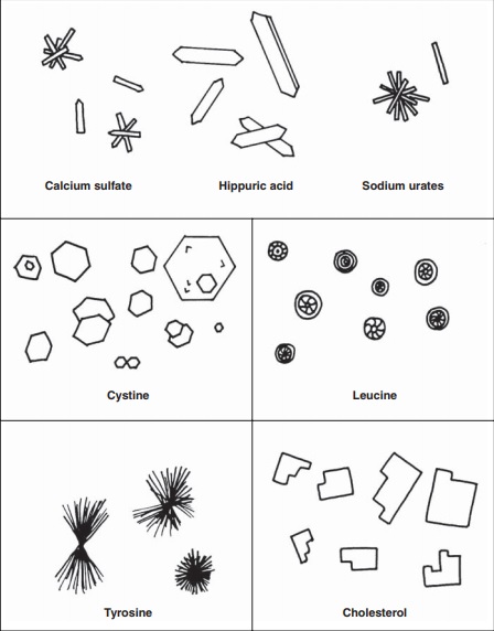 [Haematology] Microscopic Examination of Urinary Sediment - Crystals ...