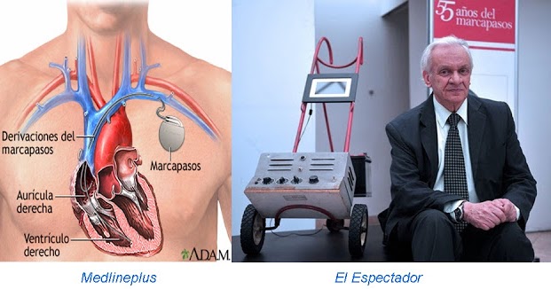 Colombiano Inventor del Marcapasos