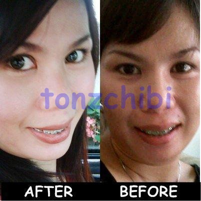 Krim WaLet 2in1 - Mencerahkan Wajah, Mengatasi Jerawat, FLek Hitam ...