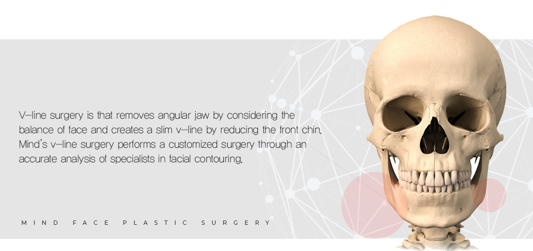 How to achieve an amazing V-line face - Korean Cosmetic Surgery Clinic ...