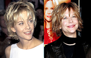 Meg Ryan Plastic Surgery Before and After Facelift and Botox - Star ...