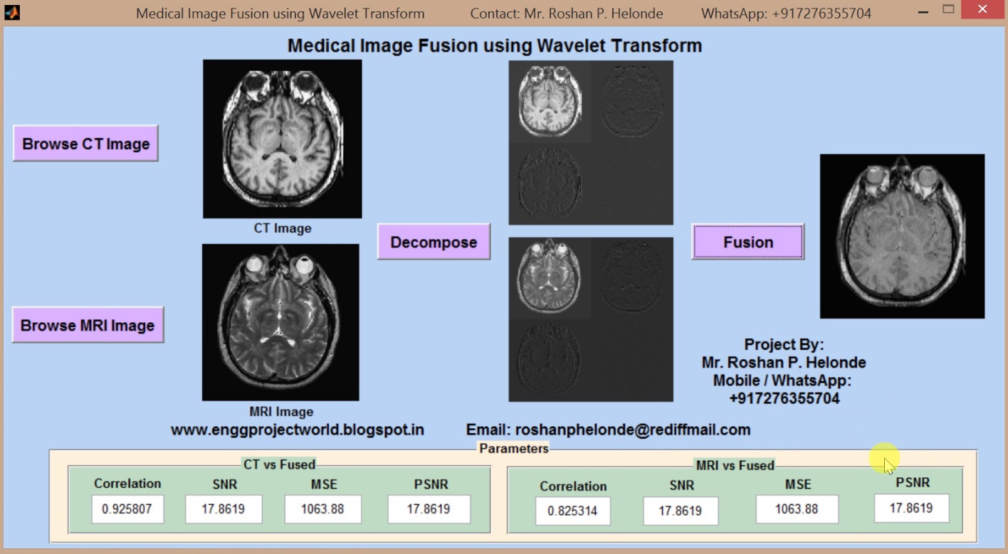 Matlab Code For Medical Image Fusion Using Wavelet Transform Image Processing Project