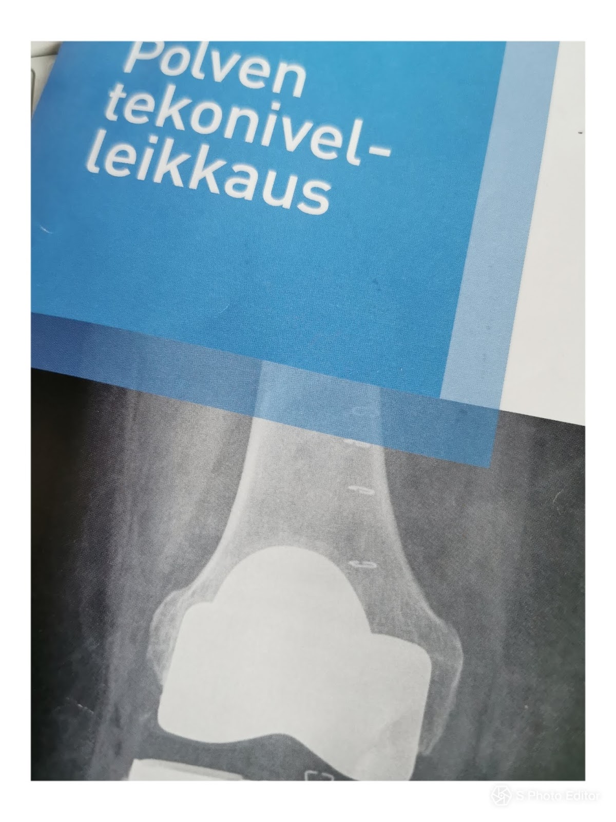 Polven tekonivelleikkauksessa