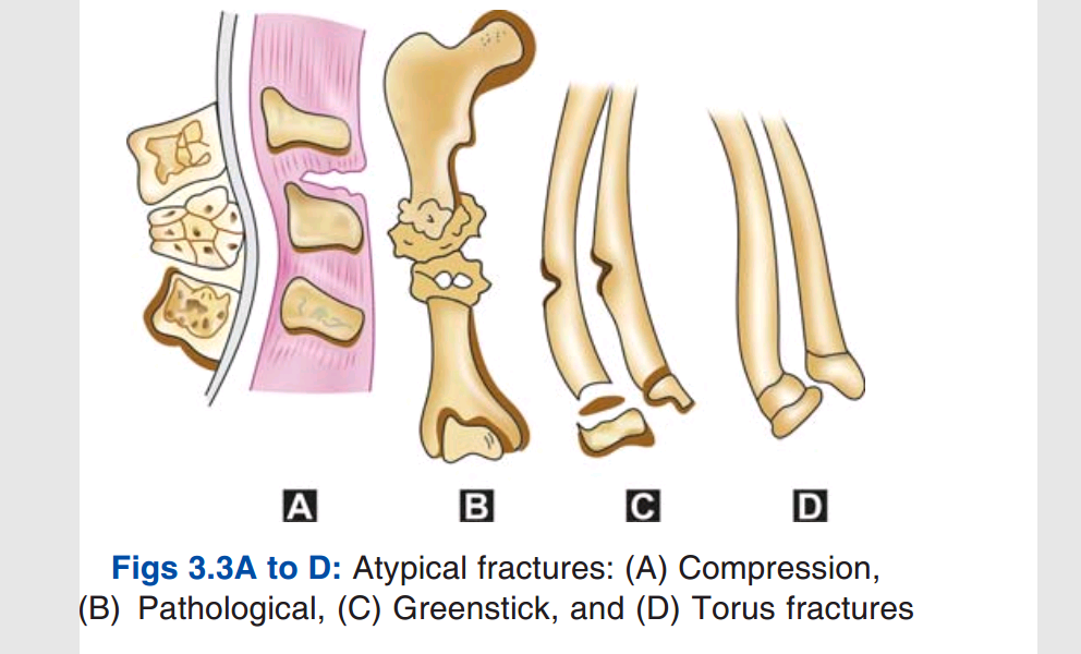 BONE FRACTURES AND DISLOCATIONS