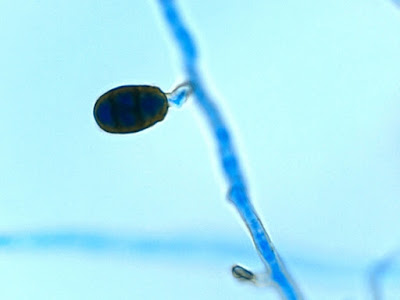 Fun With Microbiology (What's Buggin' You?): Pithomyces species